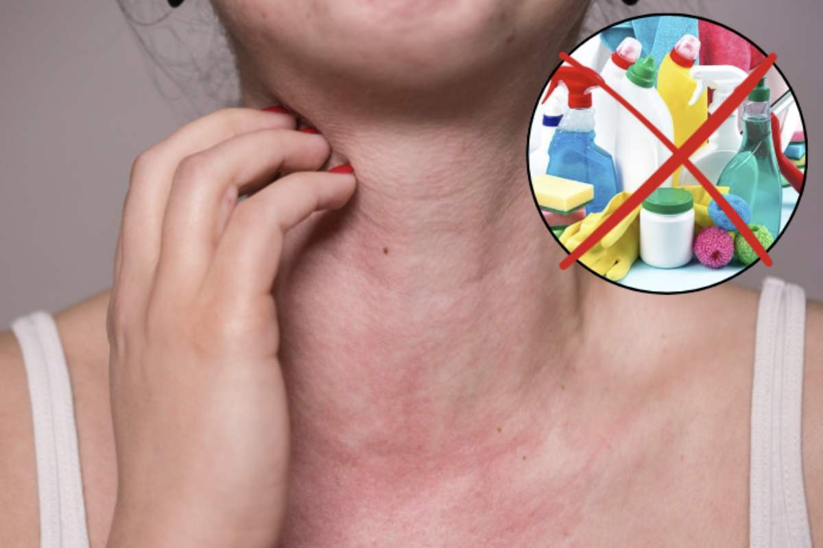 Hidden Dangers of Cleaning Products: Protect Yourself from Allergic ...